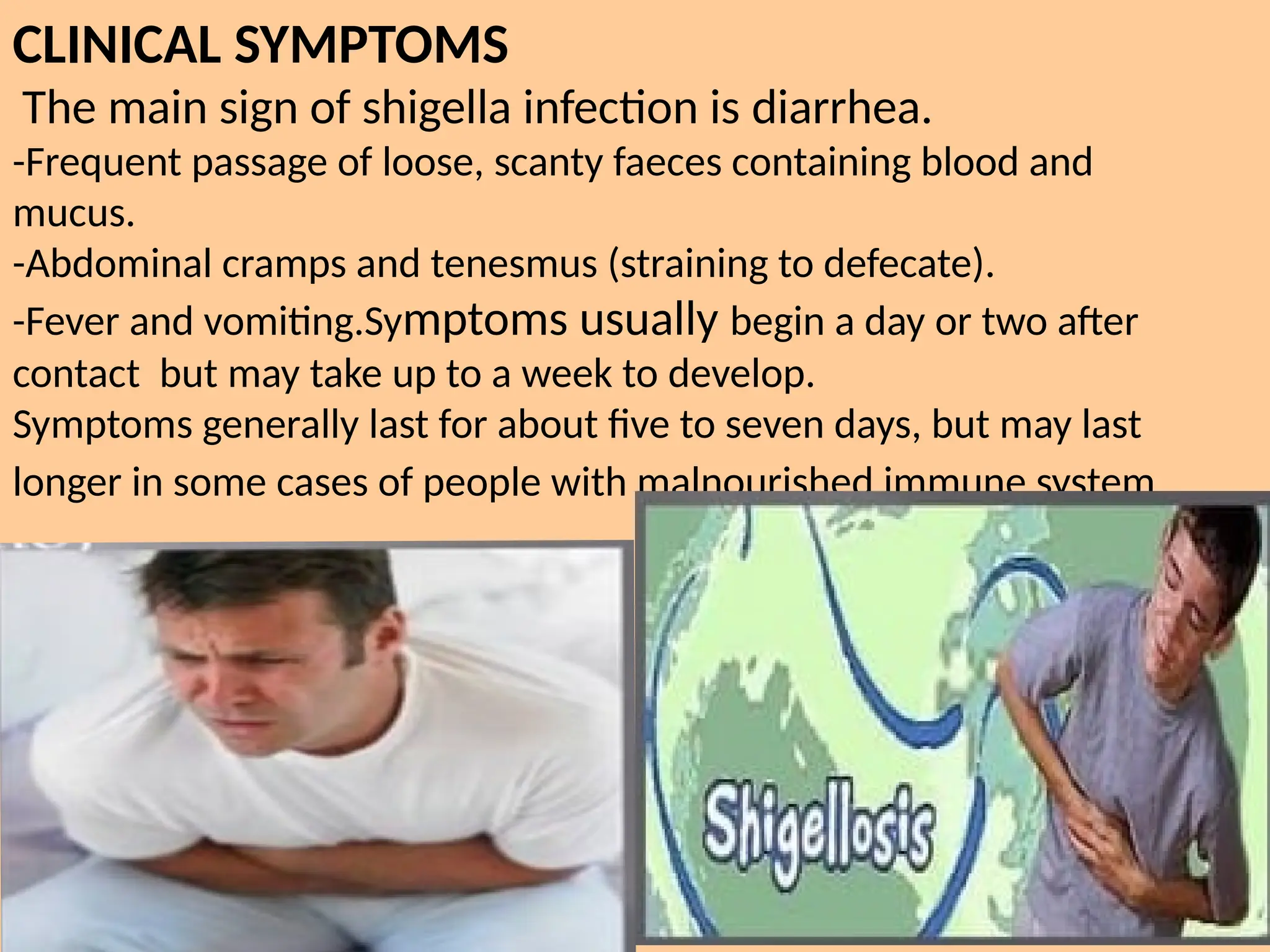 Group 3 Shigella.pptxfjfjfjffjjdjfjfjfjfjf | PPTX