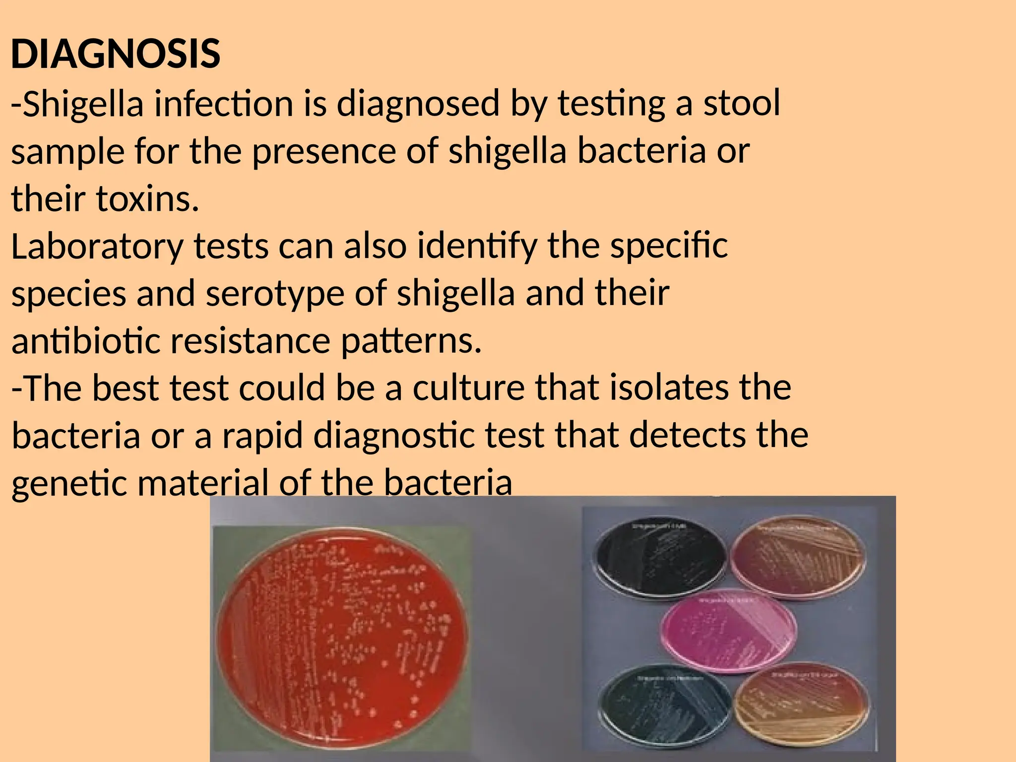 Group 3 Shigella.pptxfjfjfjffjjdjfjfjfjfjf | PPTX | Infectious Diseases ...