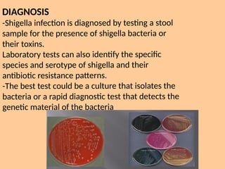 Group 3 Shigella.pptxfjfjfjffjjdjfjfjfjfjf | PPTX
