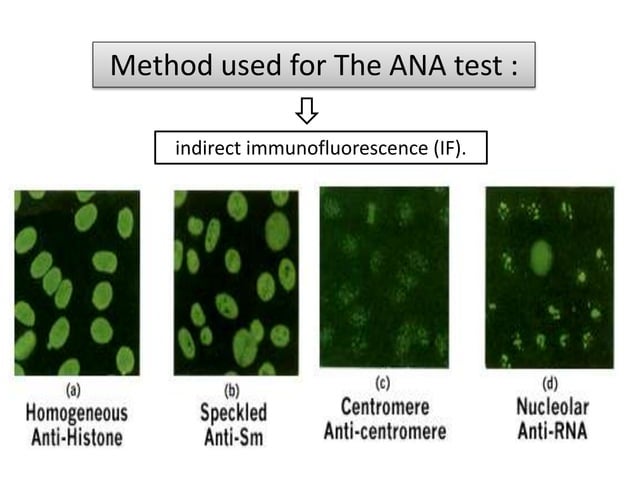 group 3 SLE CASE.pptx