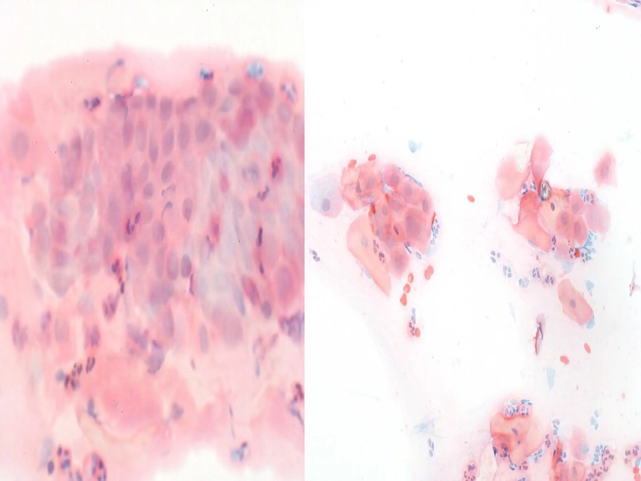 GROUP 4.pppppppppppppppppppppppppppppptx | PPT