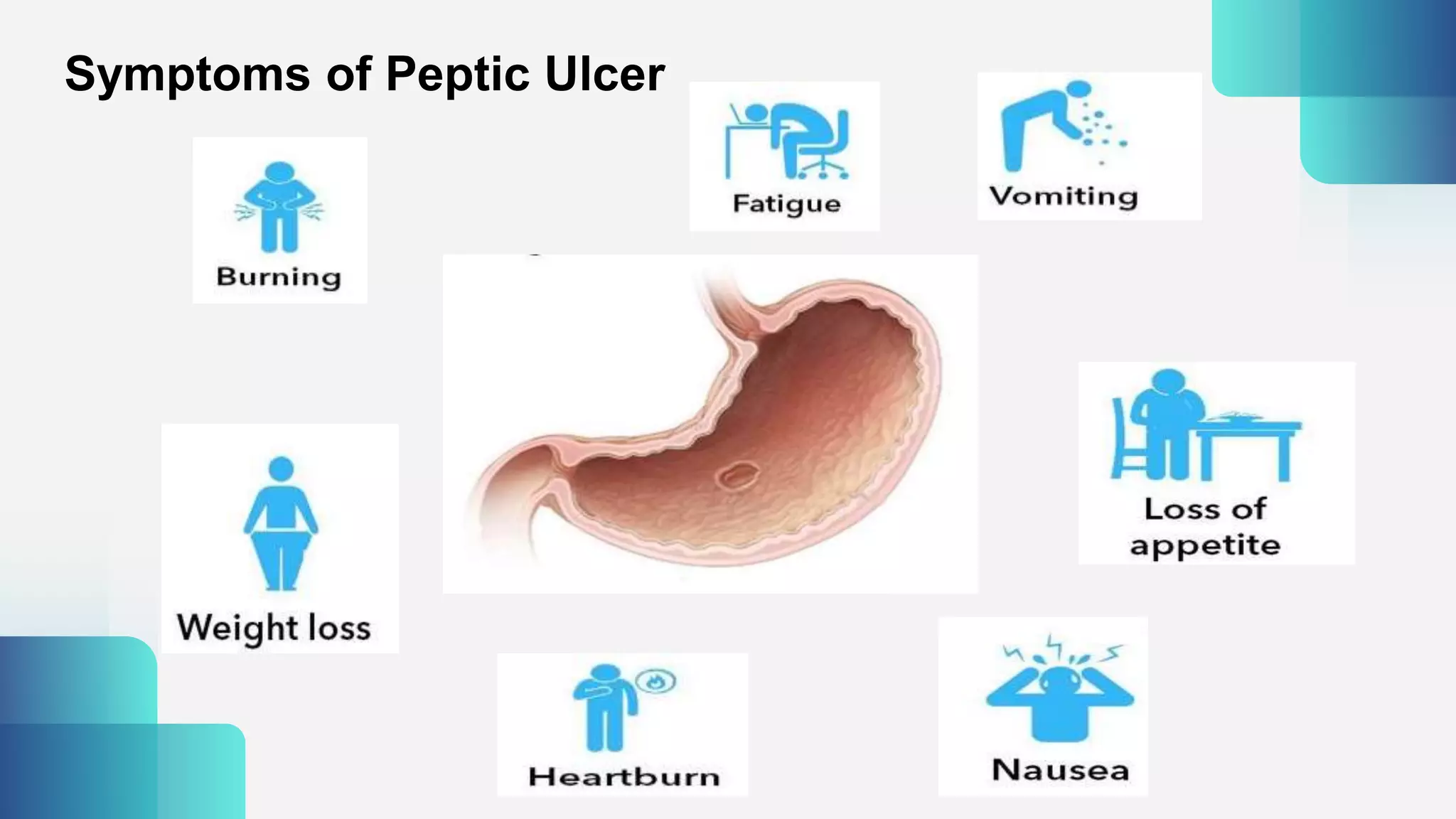 Peptic ulcers and treatment | PPTX
