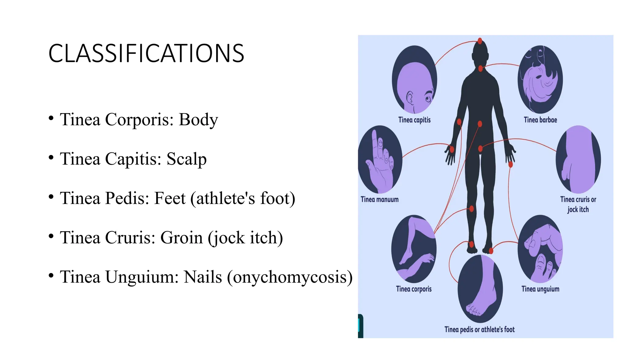 Basic Medical presentation on Dermatophytosis | PPTX