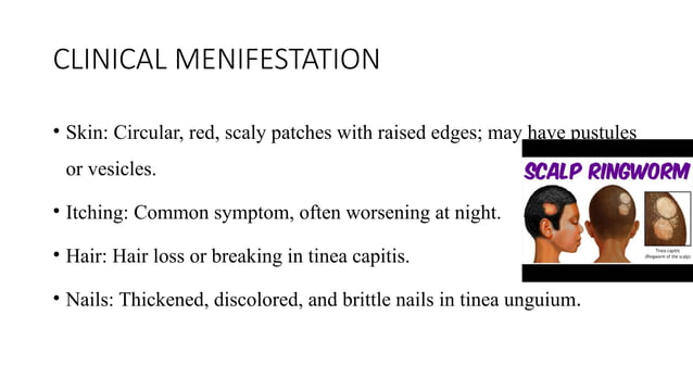 Basic Medical presentation on Dermatophytosis | PPTX