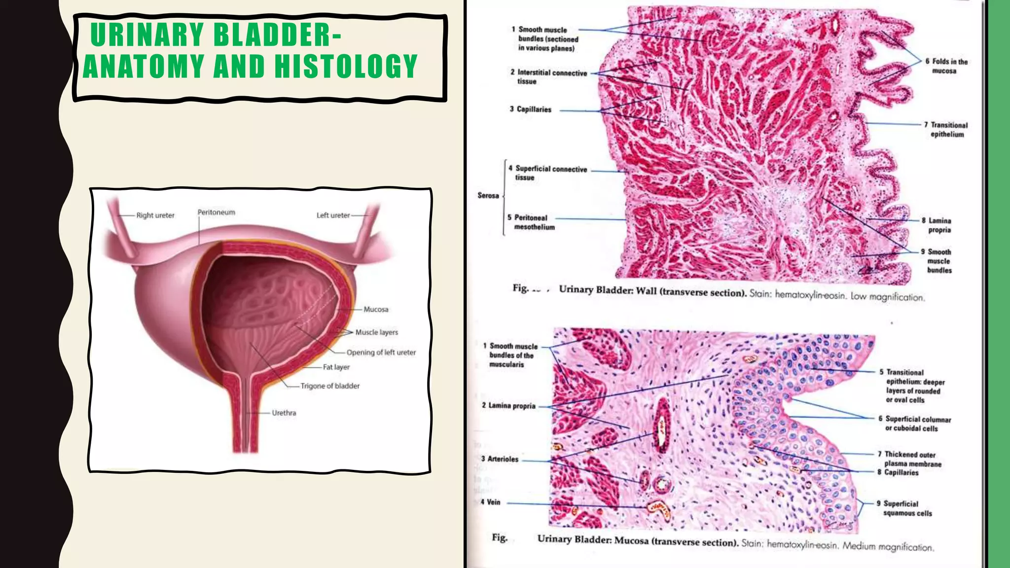 inflammatory diseases of the kidney& urinary bladder | PPTX