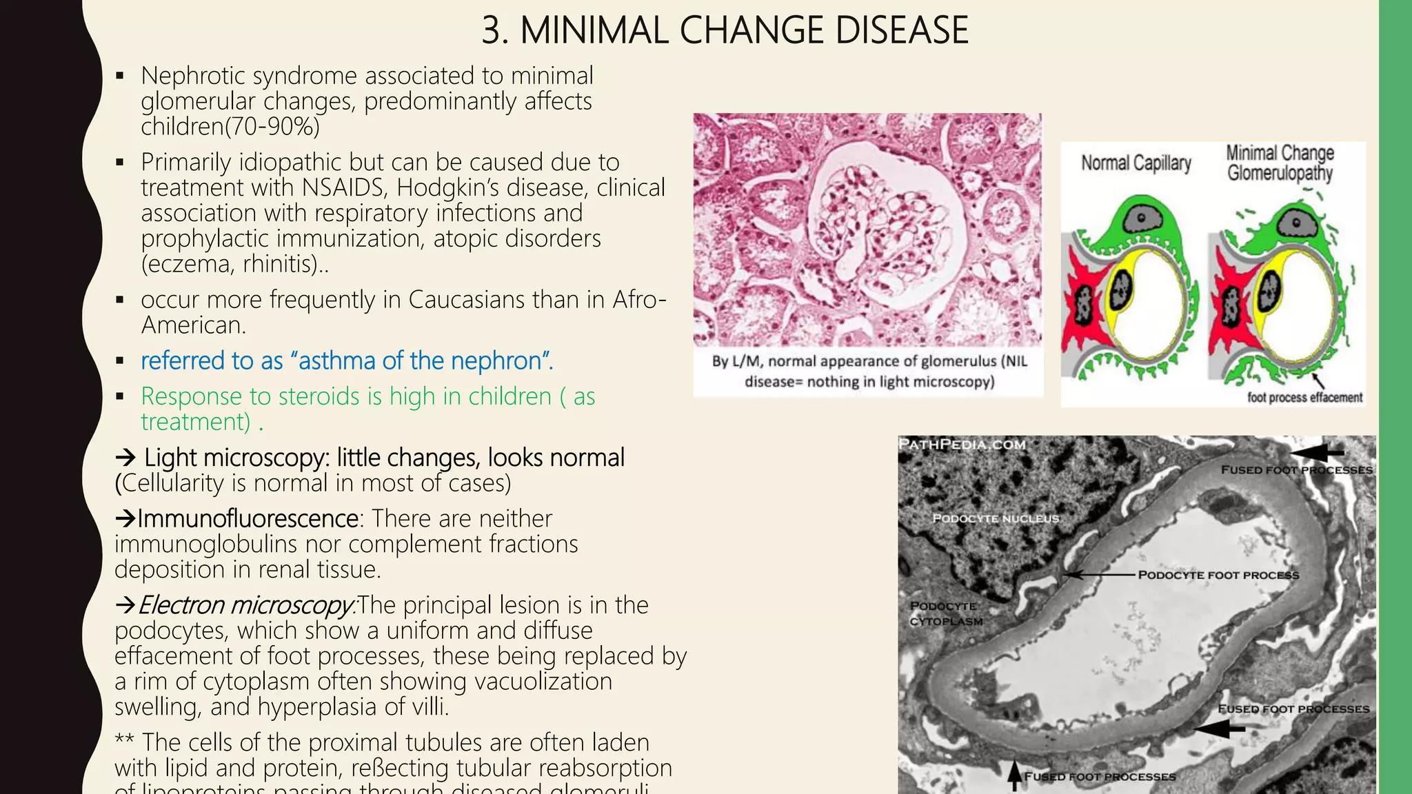 inflammatory diseases of the kidney& urinary bladder | PPTX