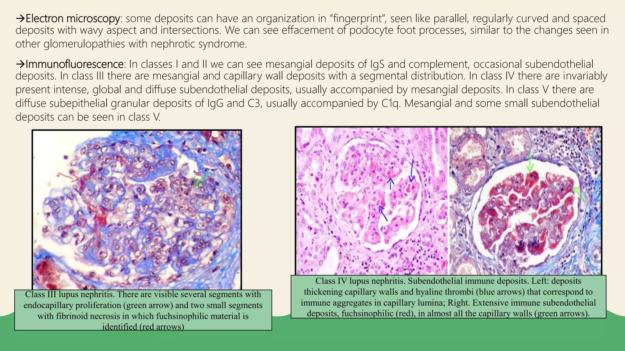 inflammatory diseases of the kidney& urinary bladder | PPTX