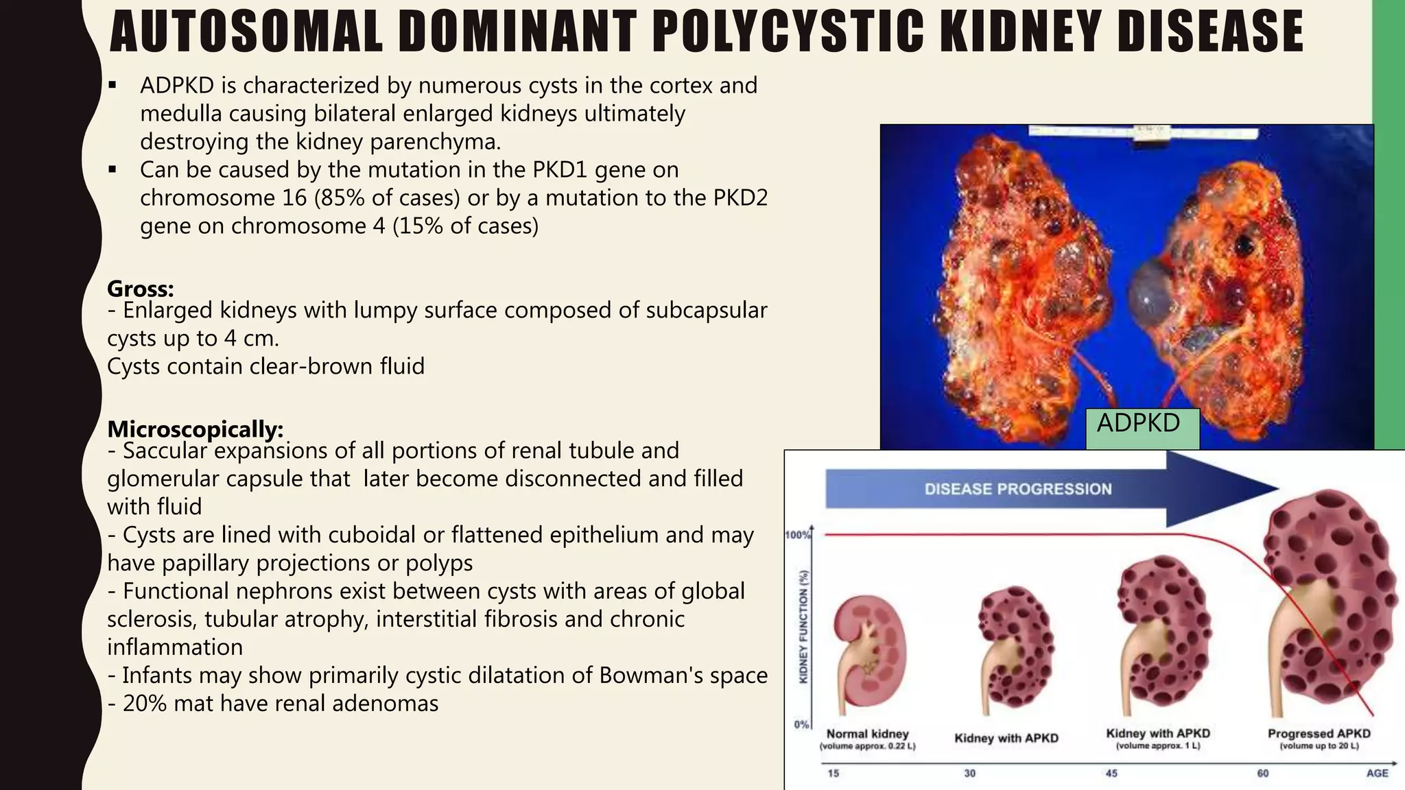 inflammatory diseases of the kidney& urinary bladder | PPTX