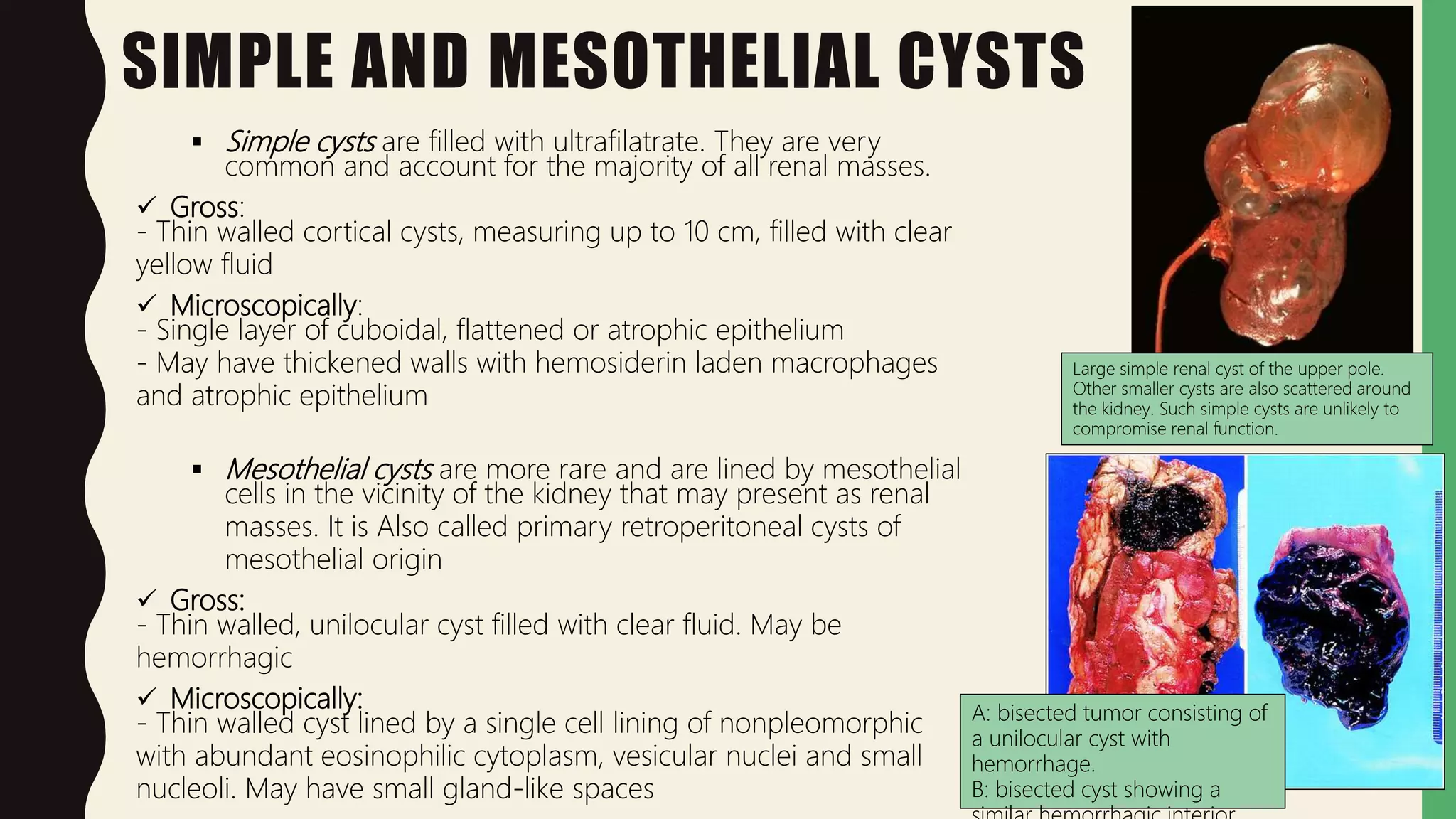 inflammatory diseases of the kidney& urinary bladder | PPTX