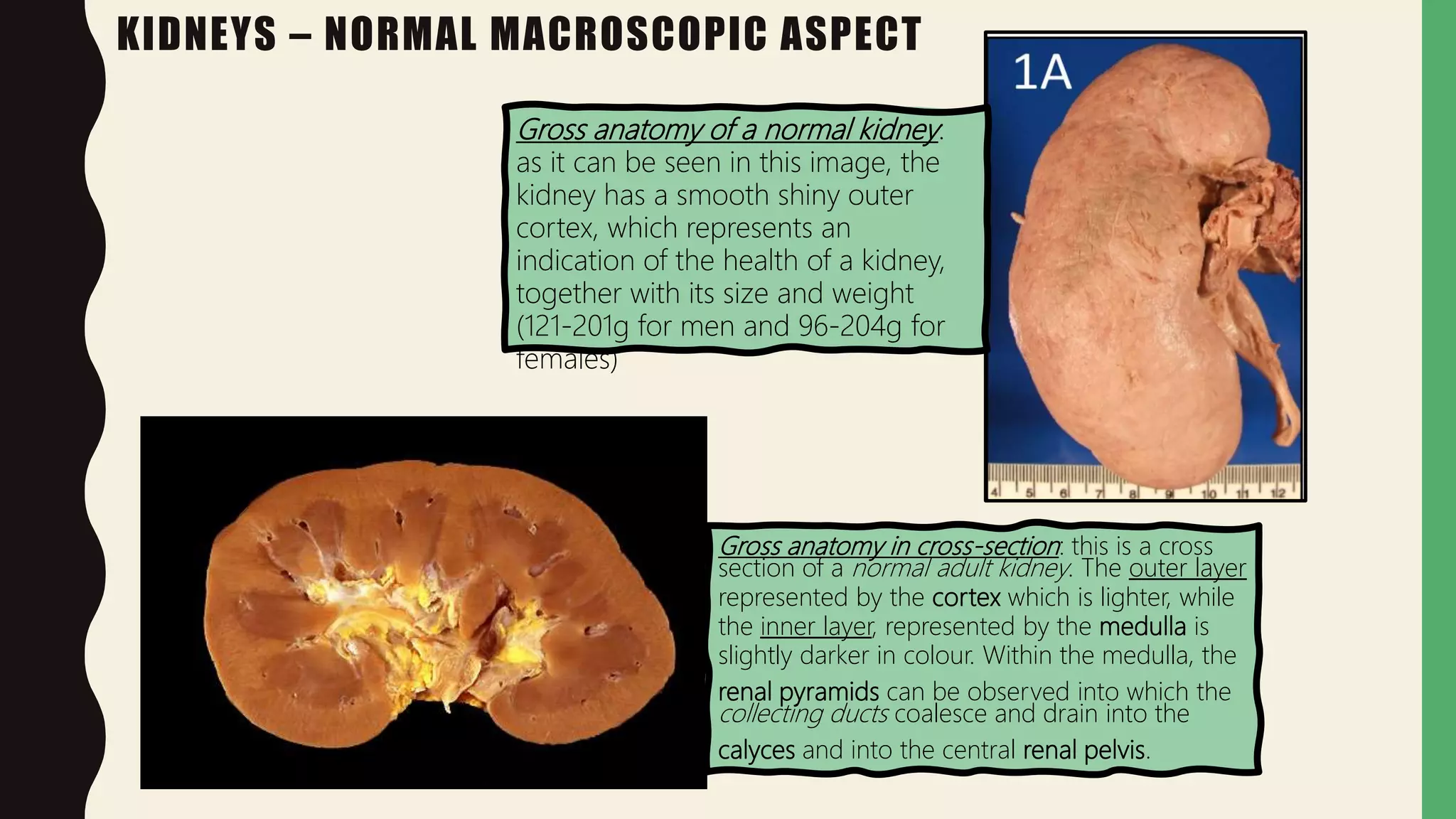 inflammatory diseases of the kidney& urinary bladder | PPTX