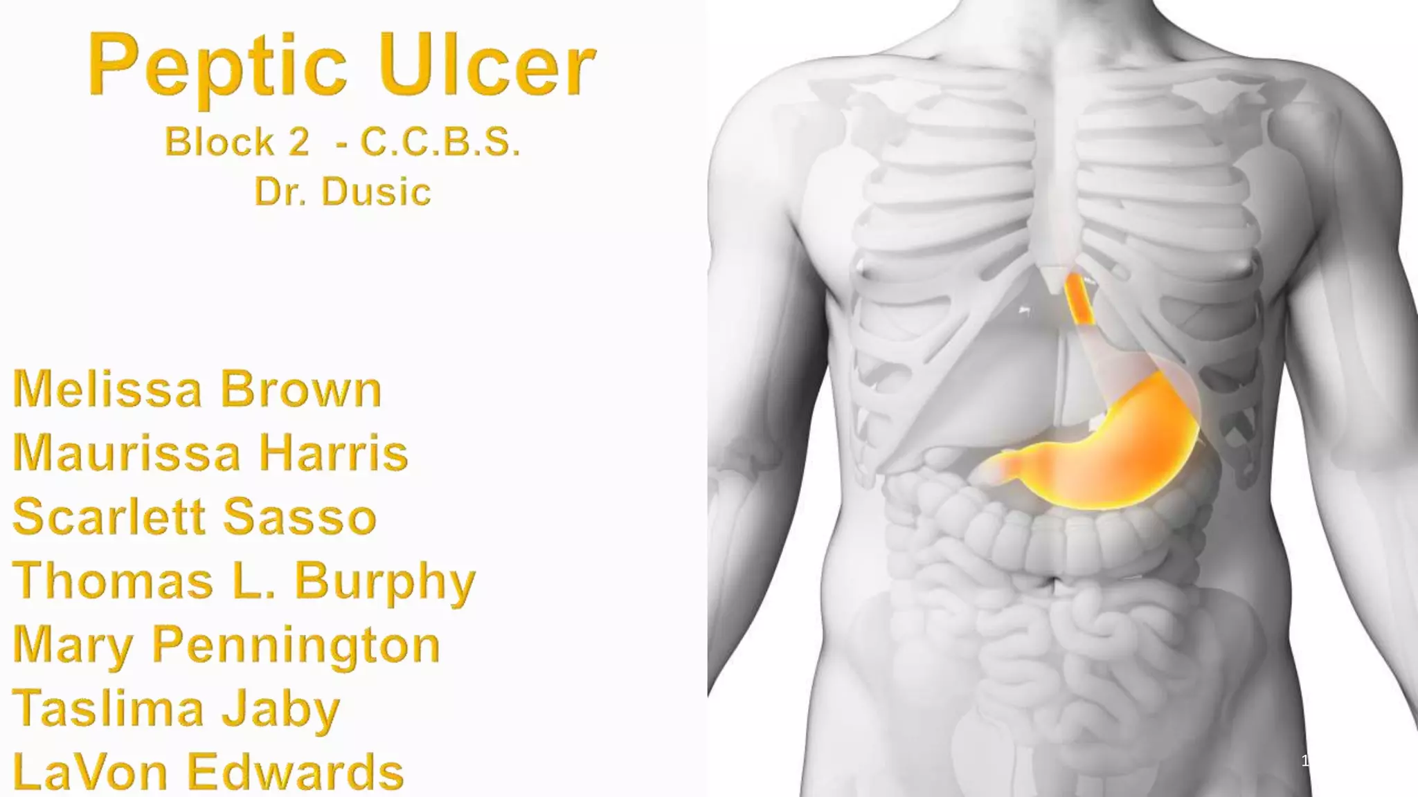 Peptic Ulcer Saint James School of Medicine | PPT