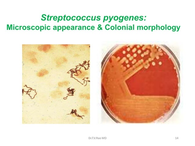 Group A Streptococcus.pptx | Infectious Diseases | Diseases and Conditions