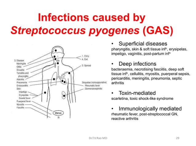 Group A Streptococcus.pptx | Infectious Diseases | Diseases and Conditions