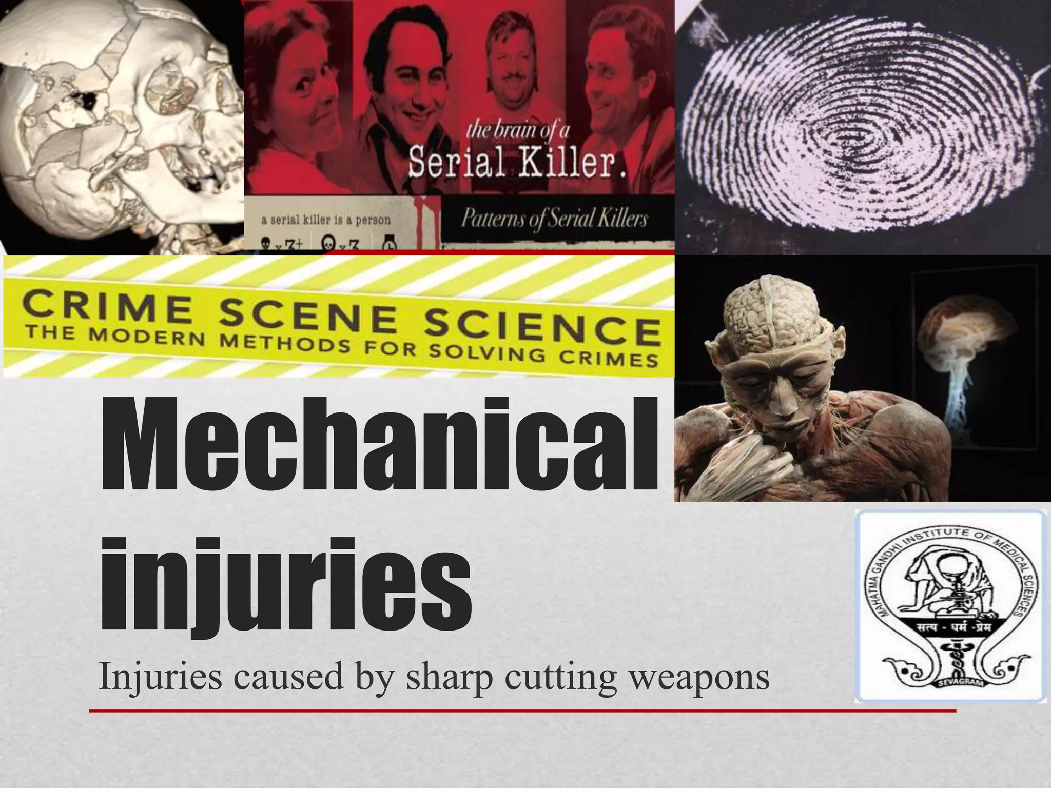 Mechanical injuries_Forensics | PPTX