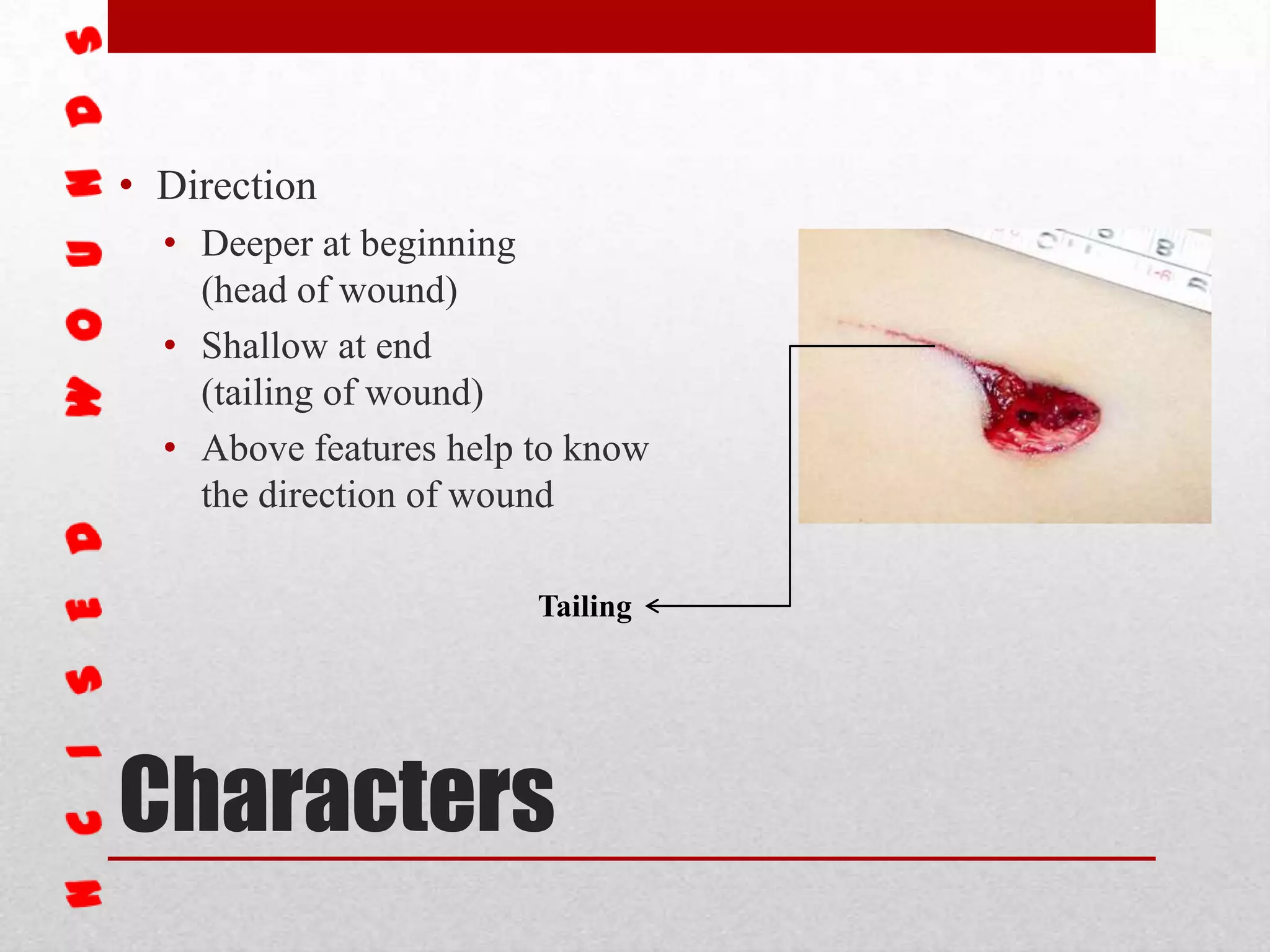 Mechanical injuries_Forensics | PPTX