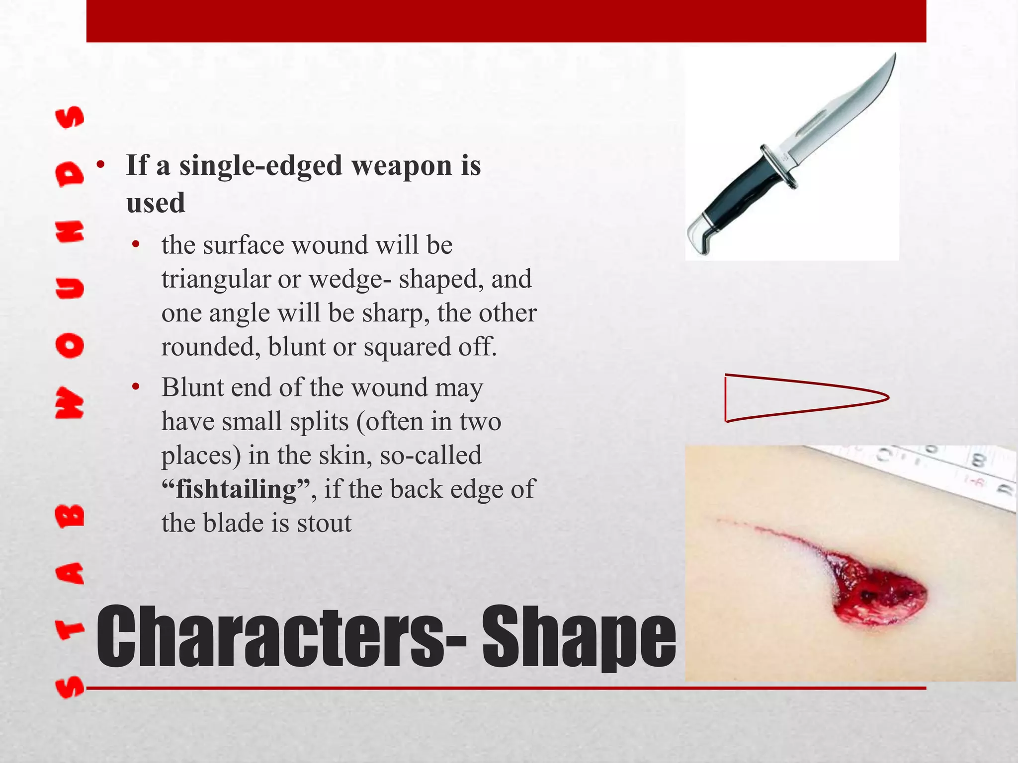 Mechanical injuries_Forensics | PPTX