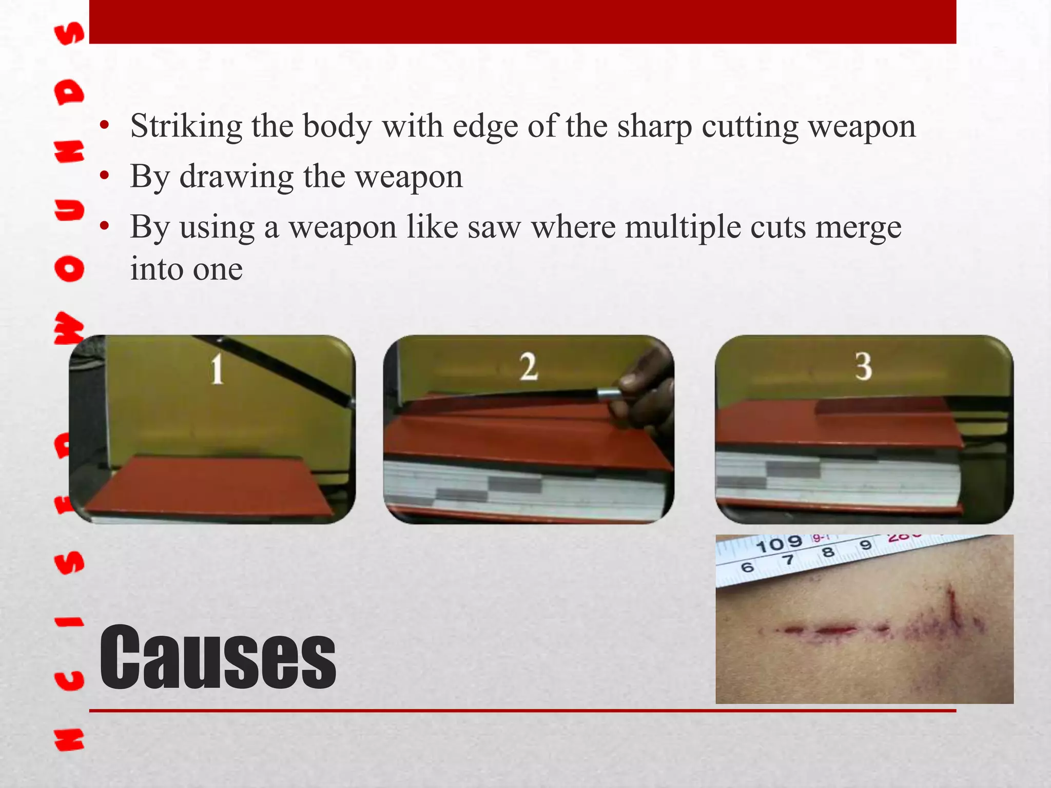 Mechanical injuries_Forensics | PPTX