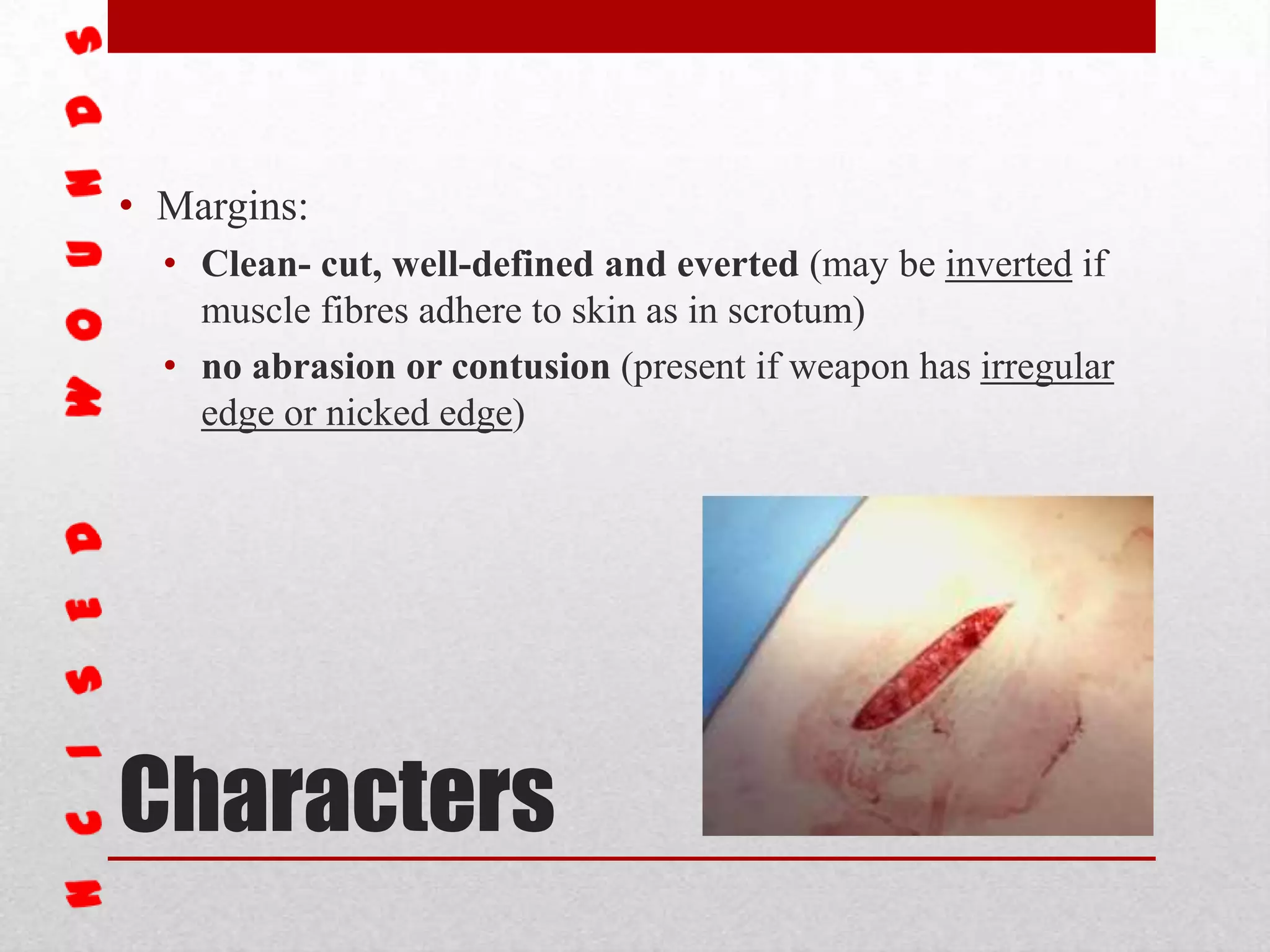 Mechanical injuries_Forensics | PPTX