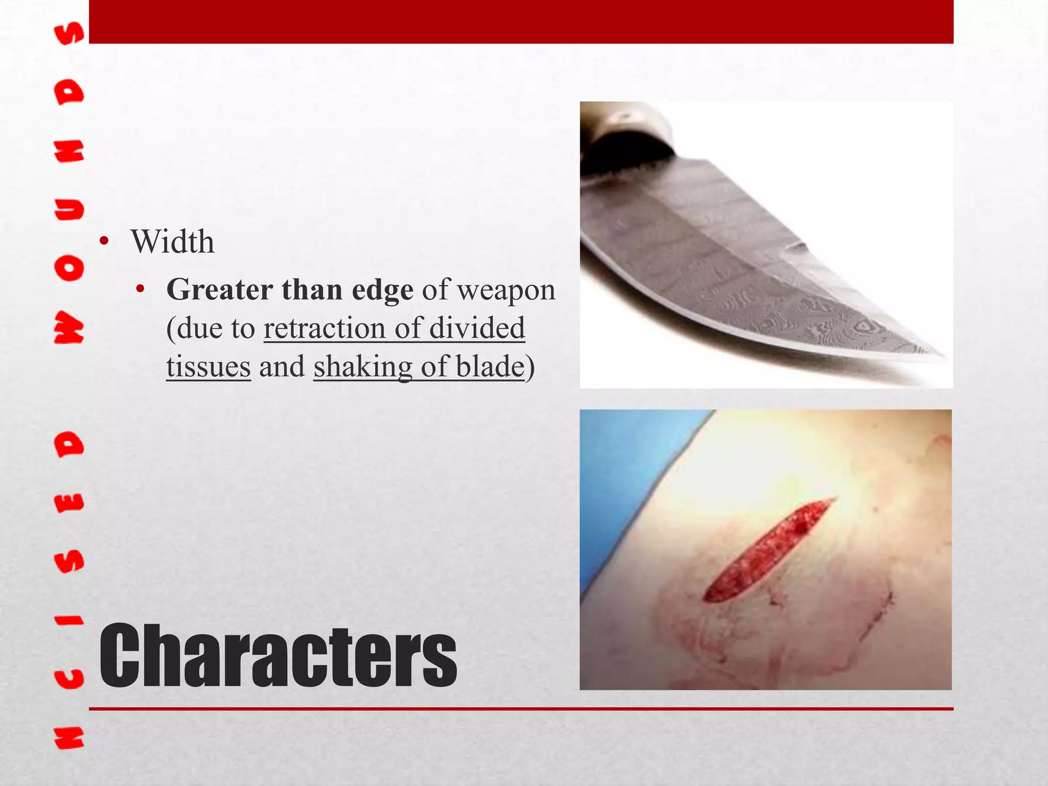 Mechanical injuries_Forensics | PPTX