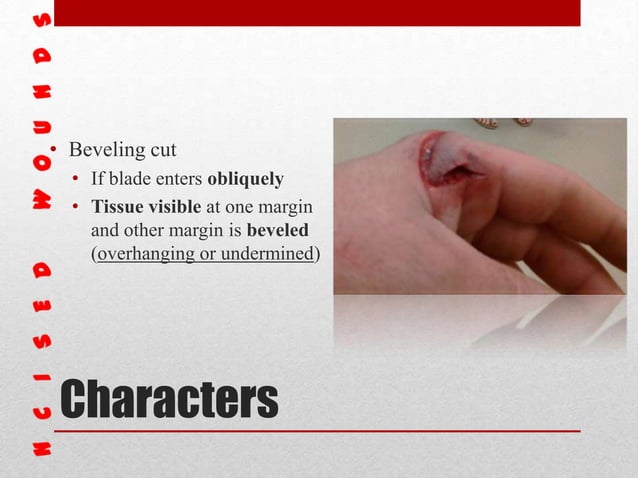 Mechanical injuries_Forensics | PPTX