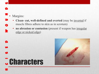 Mechanical injuries_Forensics | PPTX