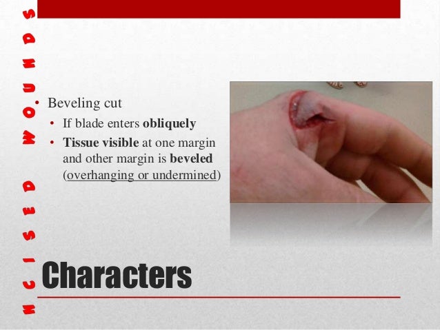 Mechanical injuries_Forensics