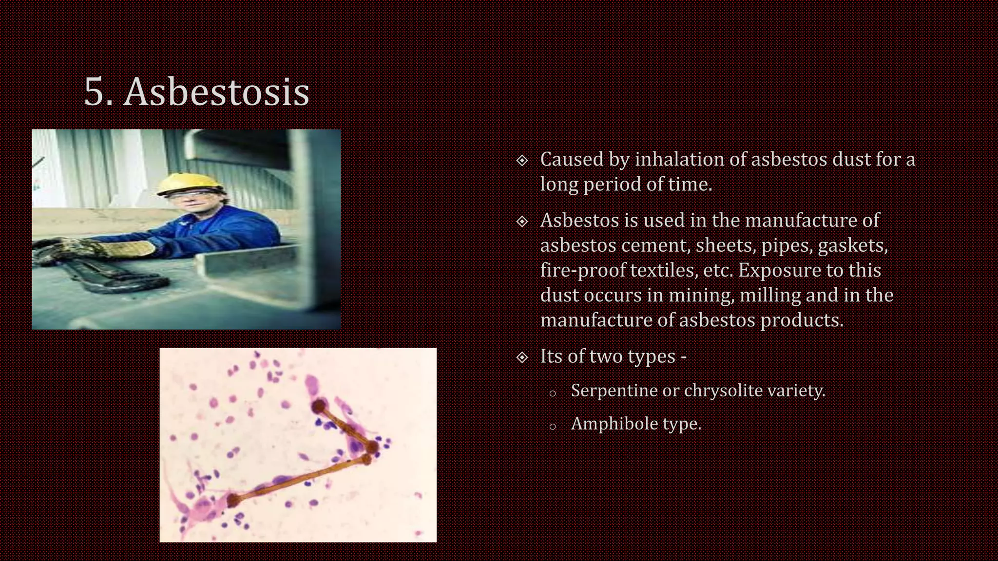 Occupational Diseases (Part 1) - Pneumoconioses | PPT