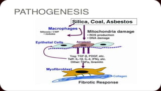 Occupational Diseases (Part 1) - Pneumoconioses | PPT