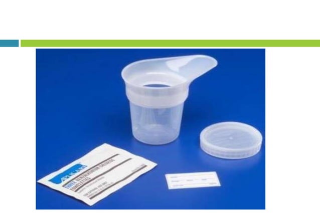 Laboratory diagnosis of urinary tract infection | PPTX