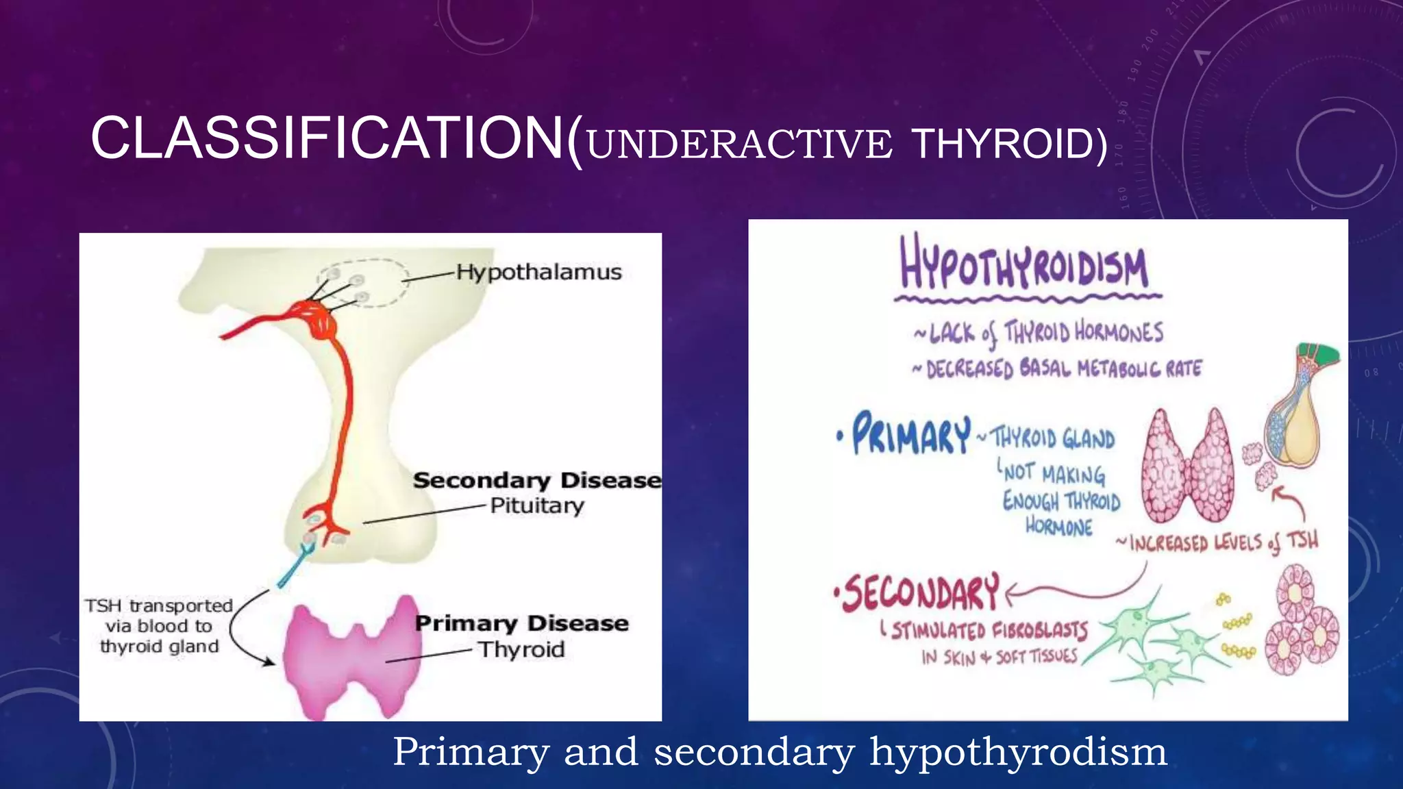 Hypothyrodism health education | PPTX