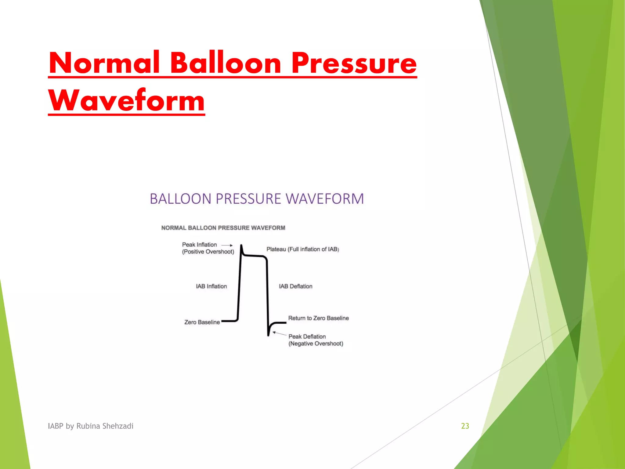 Intra Aortic Balloon Pump by Rubina Shehzadi RN | PDF