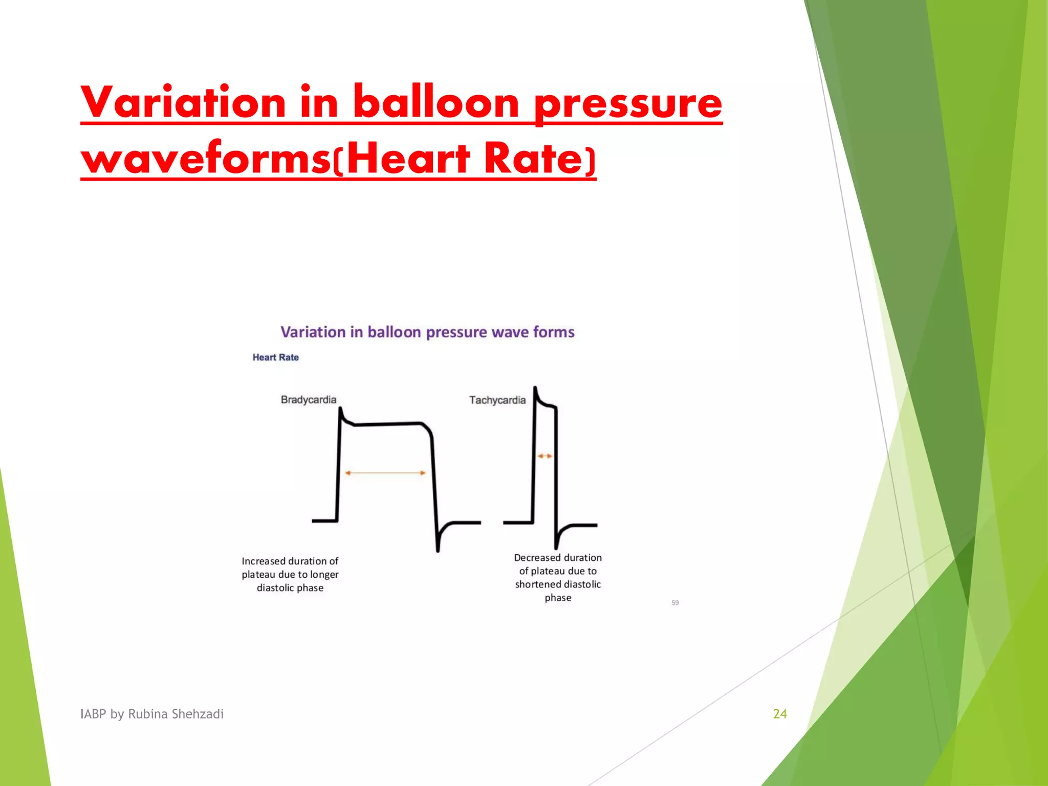 Intra Aortic Balloon Pump by Rubina Shehzadi RN | PDF