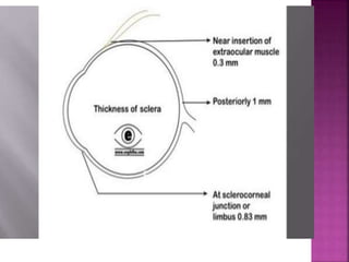 ANATOMY OF THE SCLERA | PPTX