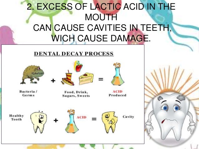 Tooth Decay Causes