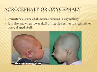 Theories of growth, mechanism of bone growth and developmental ...