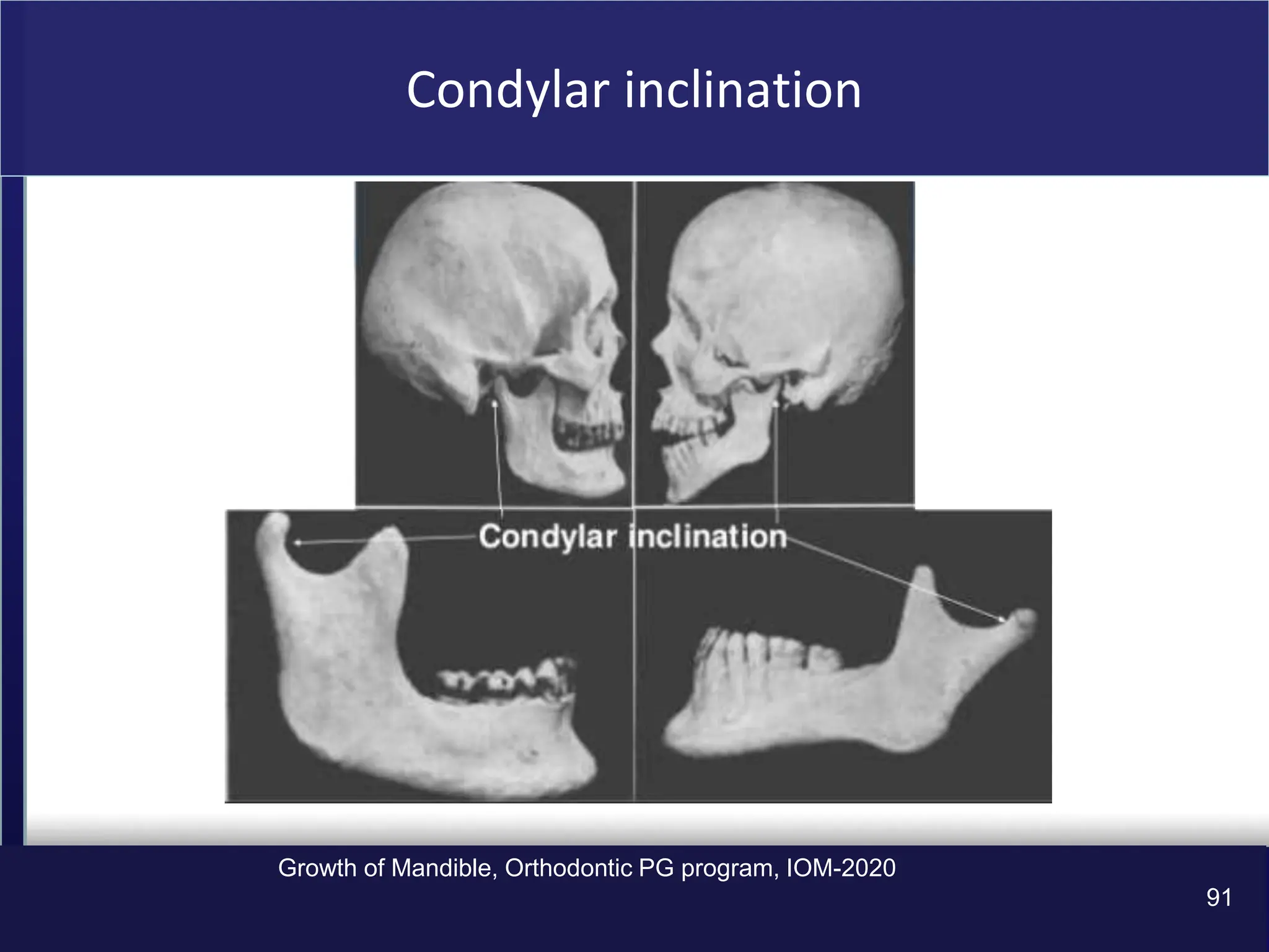 the Growth-of-Mandible in orthodontics ppt | PPT