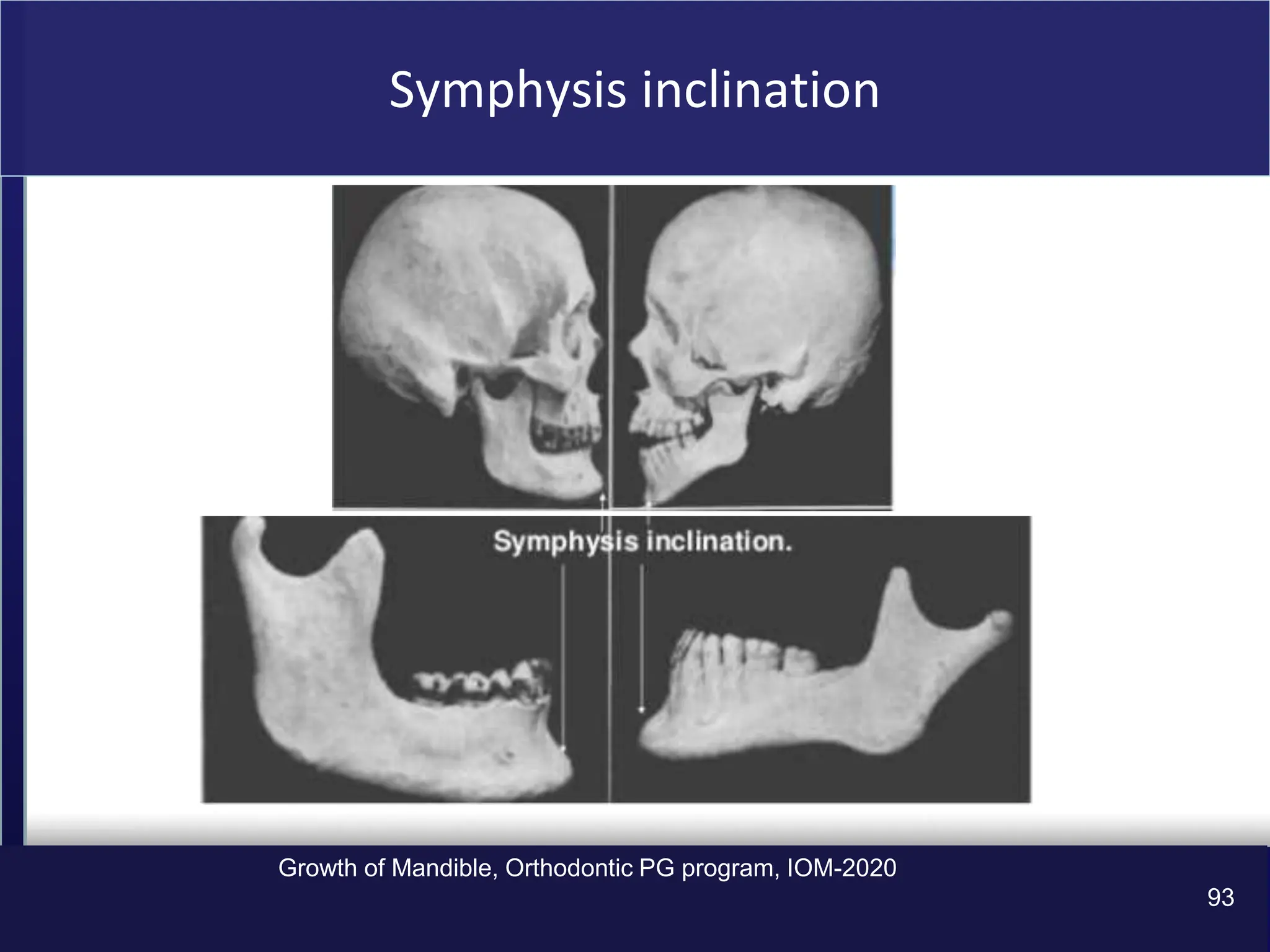 the Growth-of-Mandible in orthodontics ppt | PPT