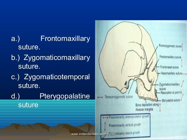 Frontomaxillary Suture
