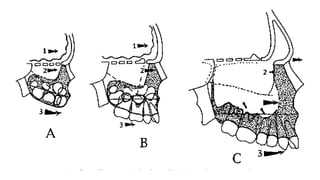 Growth and development of facial structures | PDF