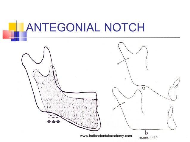 Growth and development of mandible