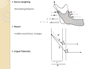 Growth and Development of mandible.pptx