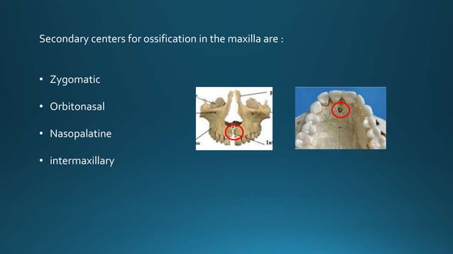 GROWTH AND DEVELOPMENT OF MAXILLA In prosthodontics | PPTX