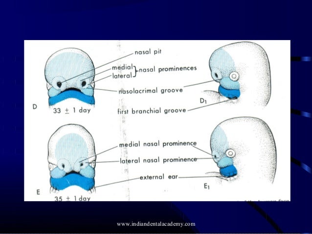 Growth and development of maxilla and maxillary sinus/ dental courses