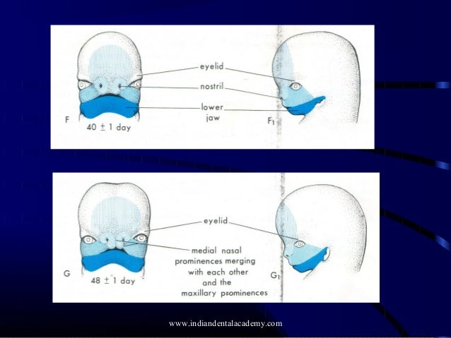 Growth and development of maxilla and maxillary sinus/ dental courses