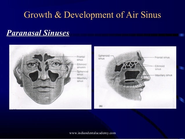 Growth and development of maxilla and maxillary sinus/ dental courses