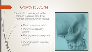 Nasomaxillary Suture