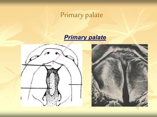 Growth and Development of Nasomaxillary complex PPT.ppt