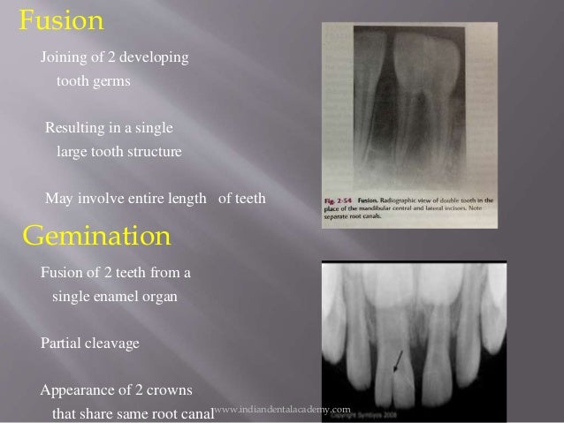 Growth and development of tooth / orthodontics courses