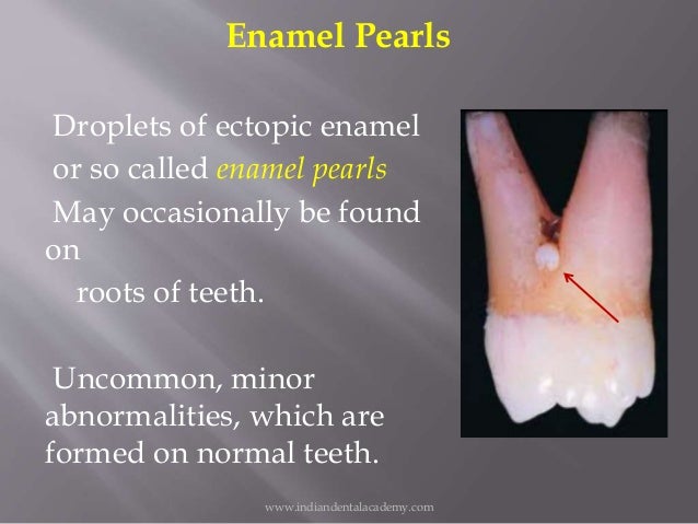 Growth and development of tooth / orthodontics courses