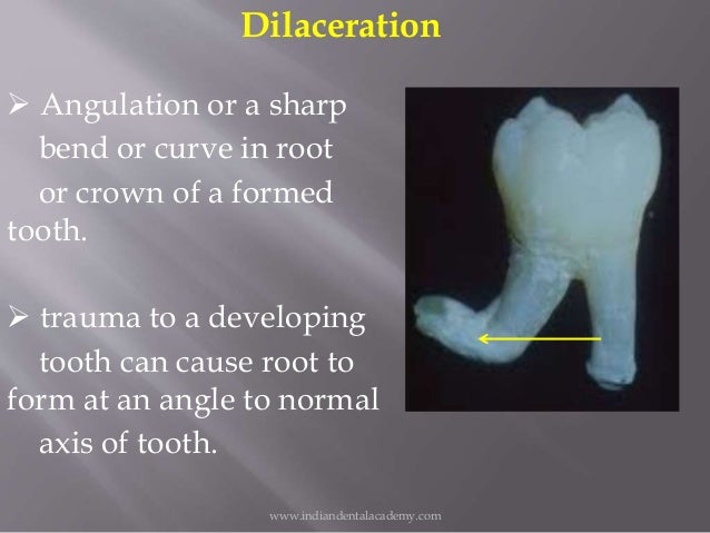 Growth and development of tooth / orthodontics courses